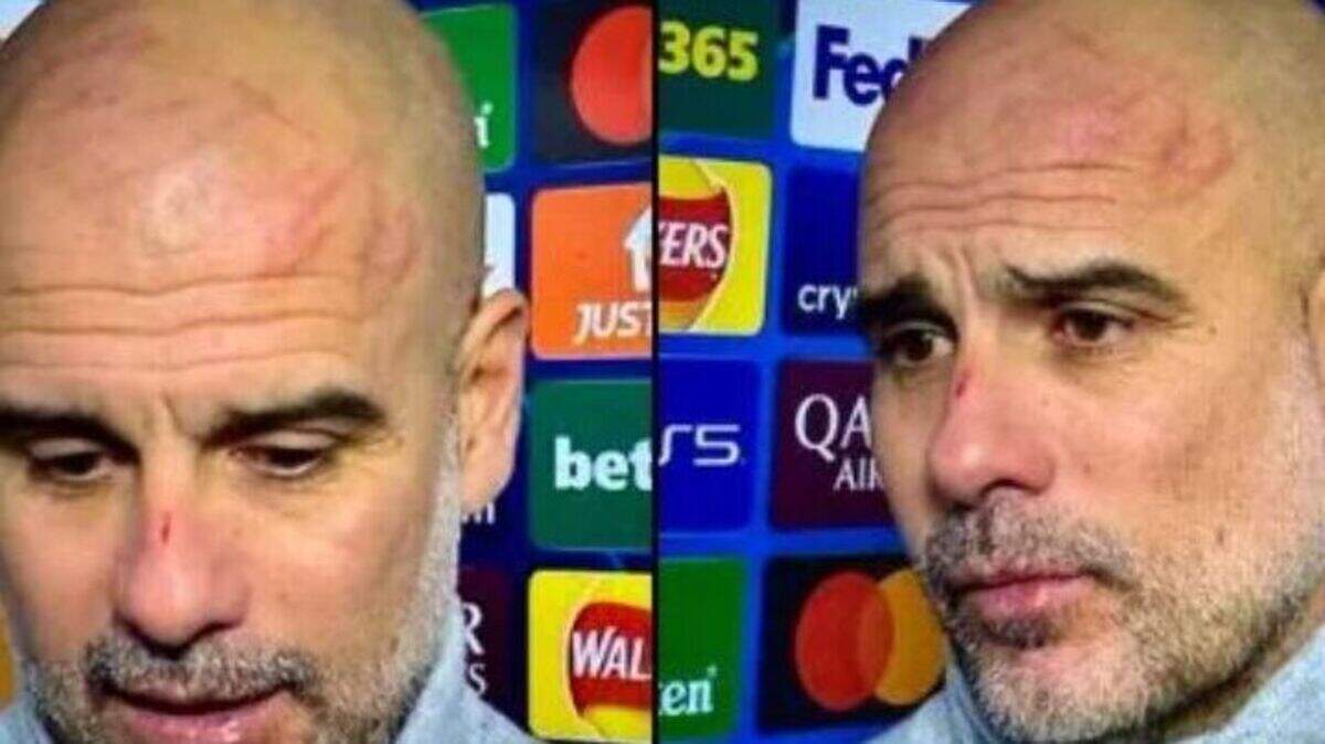 Pep Guardiola insists no intent to ‘make light’ of self harm in nose ...
