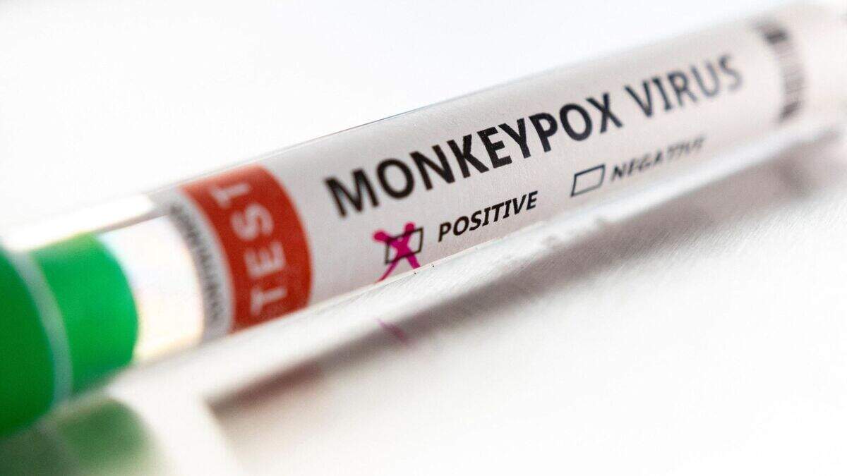 Monkeypox outbreak ‘inevitable’ in Ireland, says infectious disease ...