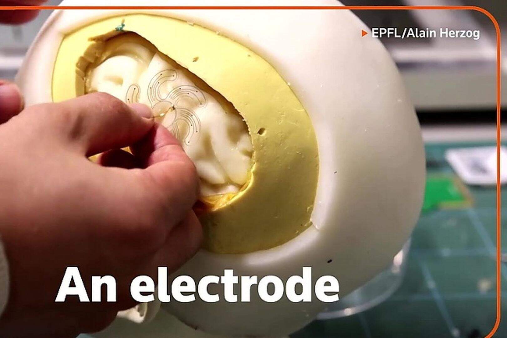 Swiss scientists develop electrode which can be used to treat epilepsy ...