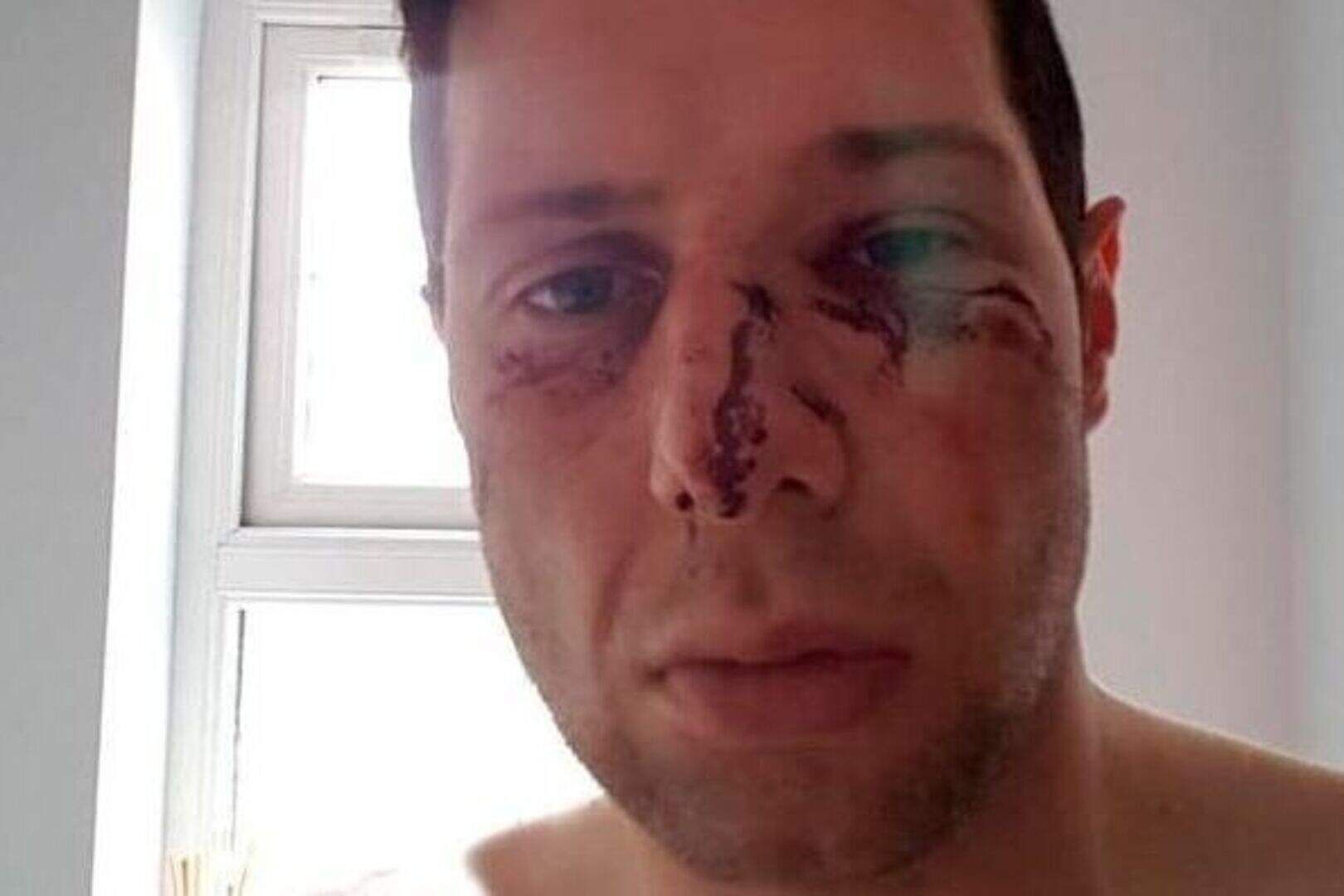 Moy appeal Tyrone's decision not to pursue action over Sean Cavanagh ...