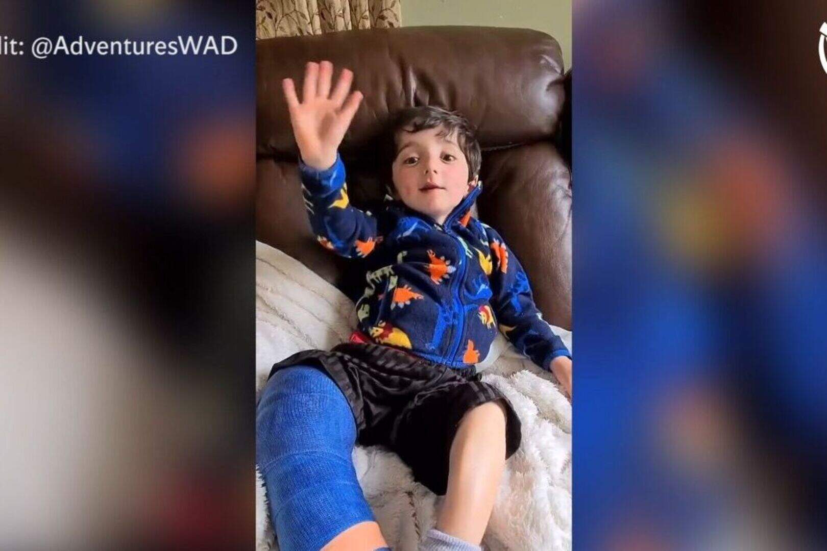 Adam King gives update on his leg and thanks well-wishers | Irish ...