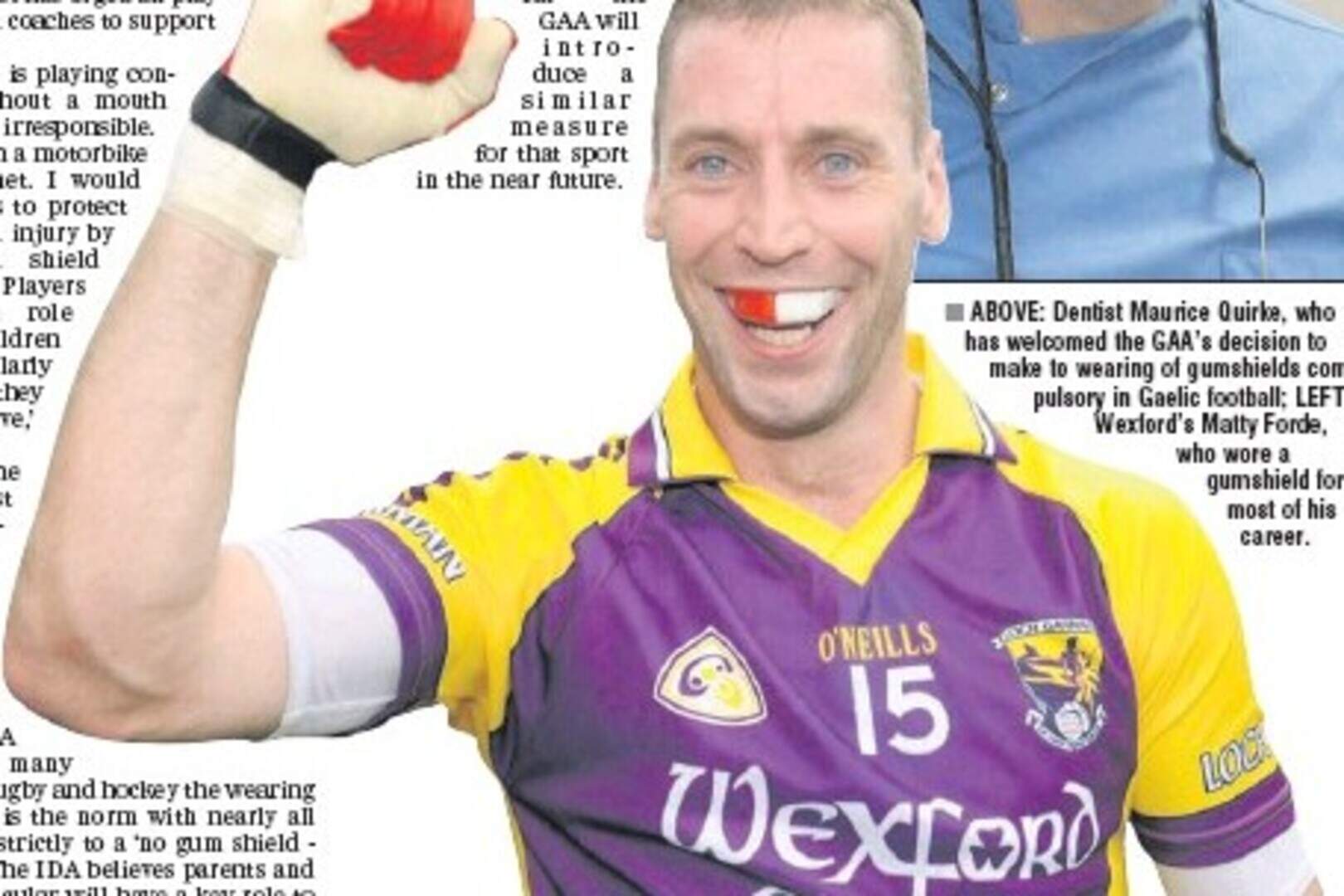 GAA'S gumshield rule welcomed by dentist | Irish Independent