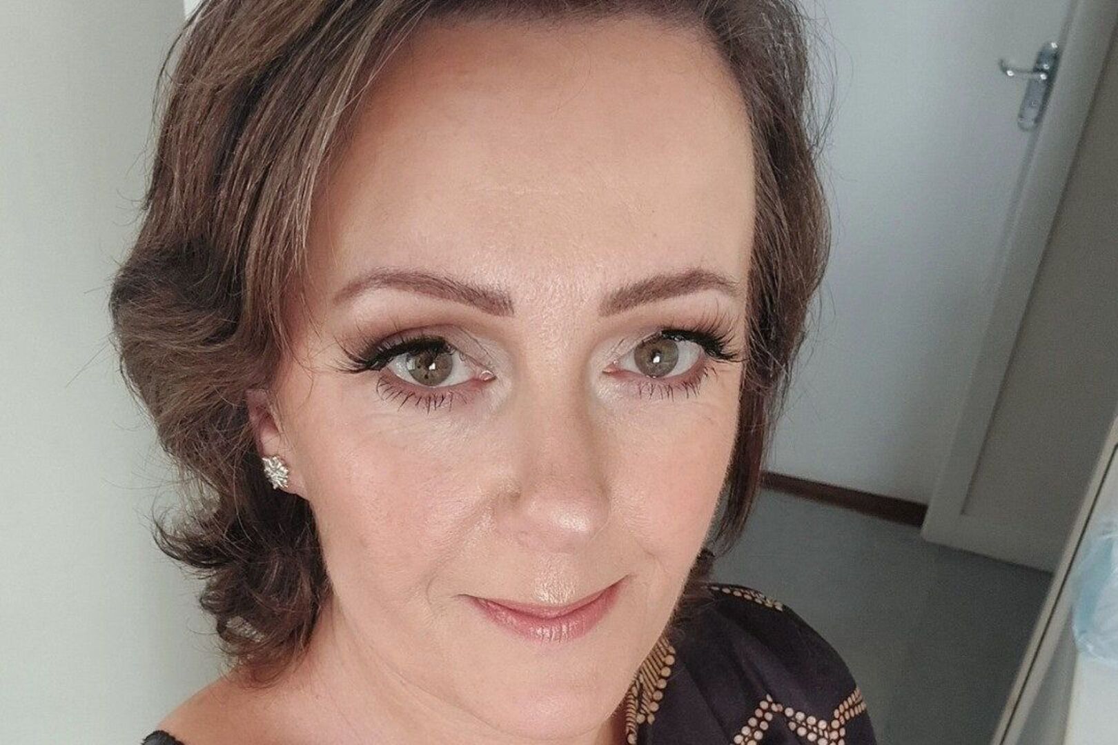Offaly skin cancer survivor shares story to warn of sun dangers: ‘You ...