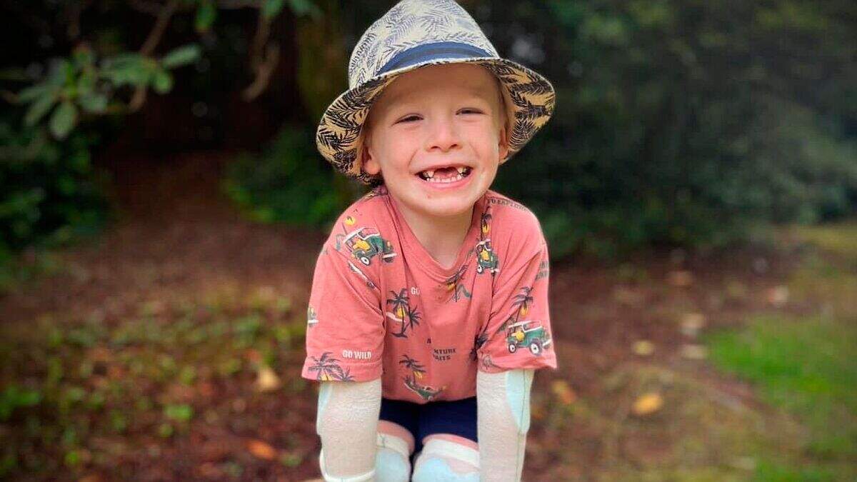 Personal booklet helps Bobby (4) explain his painful butterfly skin ...