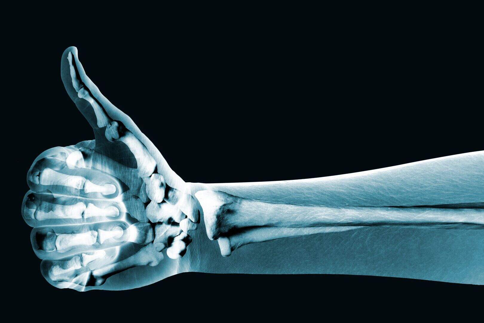‘Glue’ for broken bones among projects to split €95m funding | Irish ...